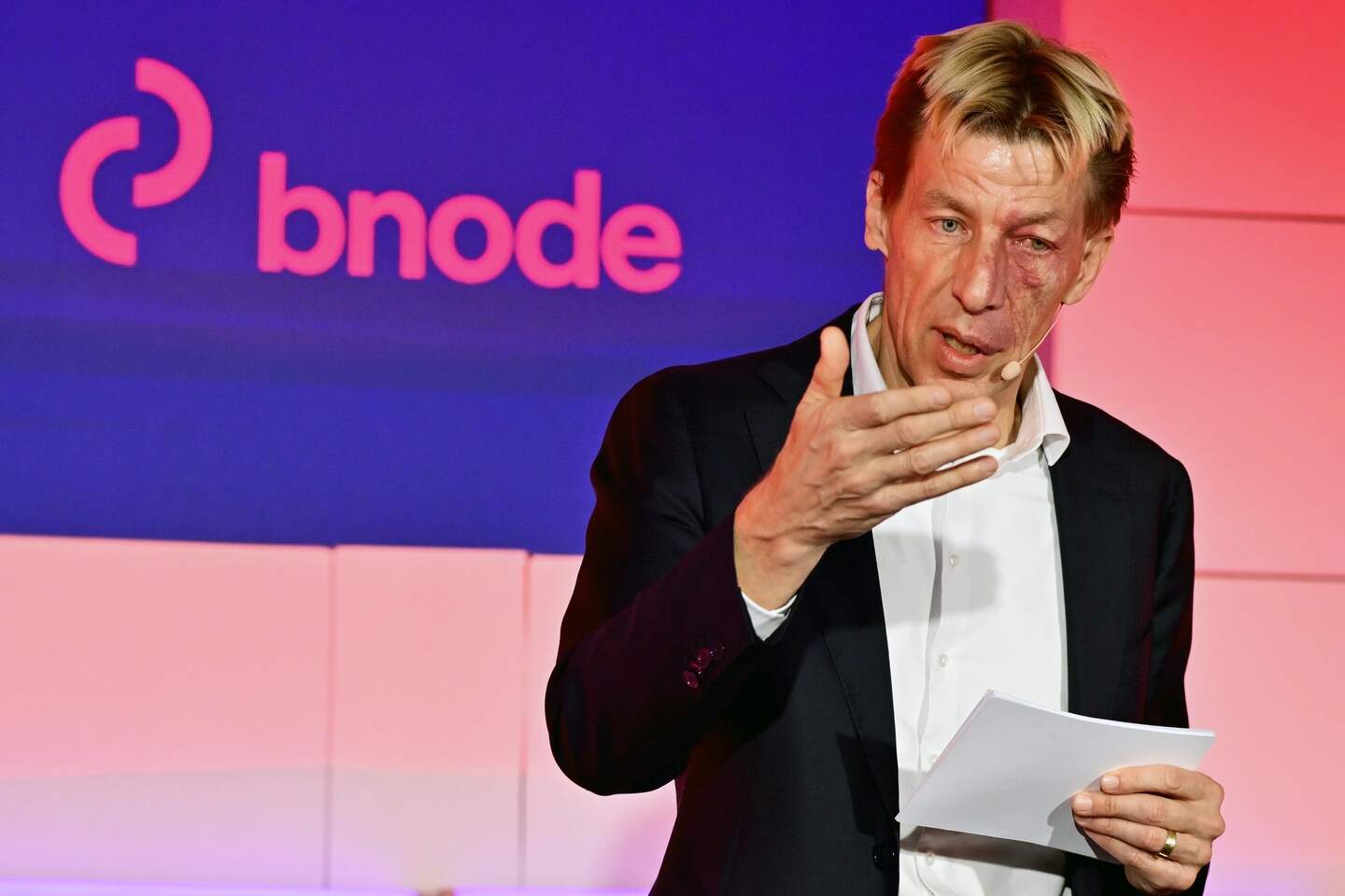Herstructurering vermijden wordt een uitdaging na de recordstaking bij ...